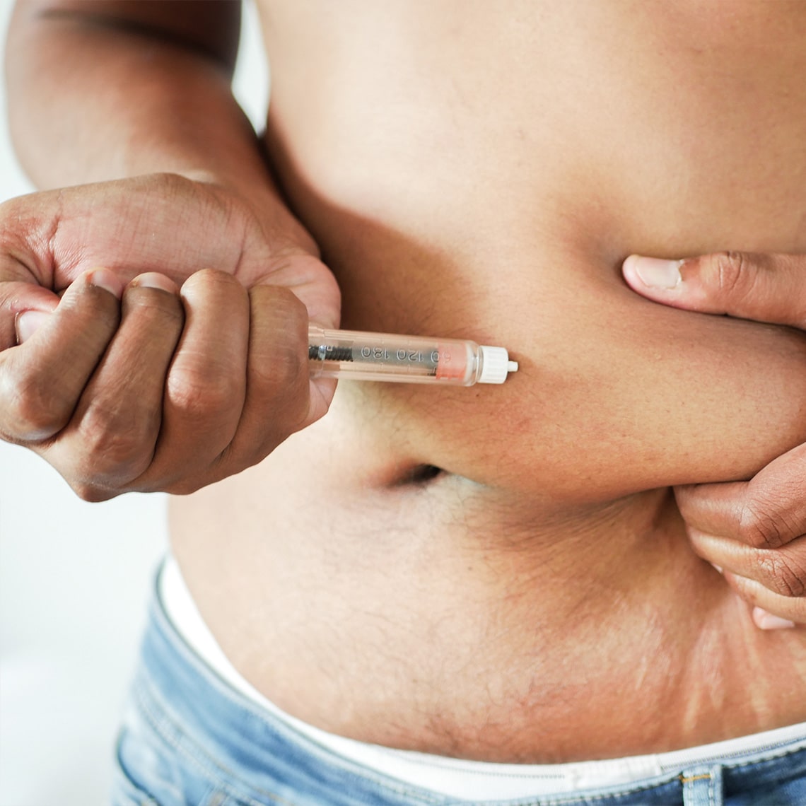 Fettwegspritze - Dr. med. Victoria Lazarescu